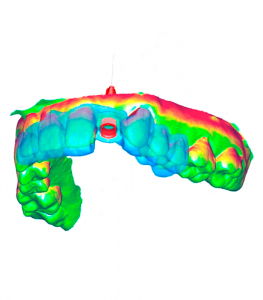 Romexis 3D Implant Guide - Guias Cirúrgicas de Forma Fácil