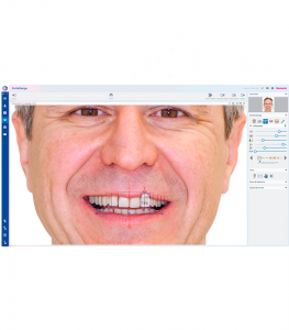 Romexis Smile Design - Desenhe Sorrisos Perfeitos